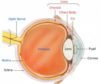 Ocular Melanoma - Symptoms, Pictures, Survival Rate, Prognosis, Treatment