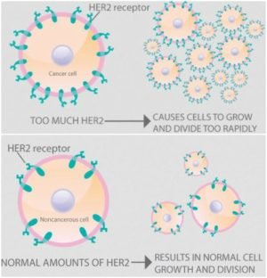HER2 Positive Breast Cancer - Prognosis, Treatment, Survival rate
